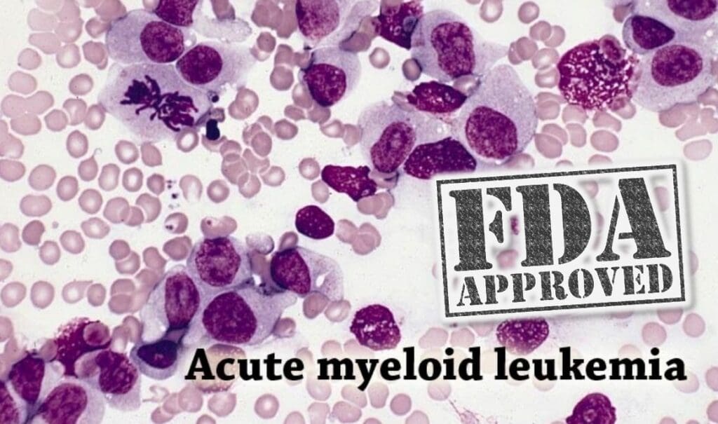 Flt3 Mutations In Aml From Trivia To Triumph — Green Bay Oncology